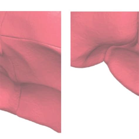 Pdf The Gallbladder And Extrahepatic Biliary Tract Anatomy And Variations