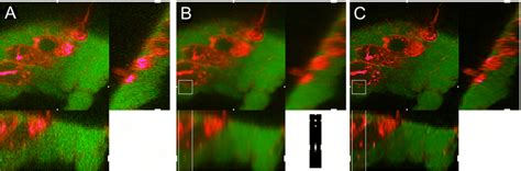 Proof Of Principle Of Psf Extraction And Deconvolution A Confocal Download Scientific Diagram