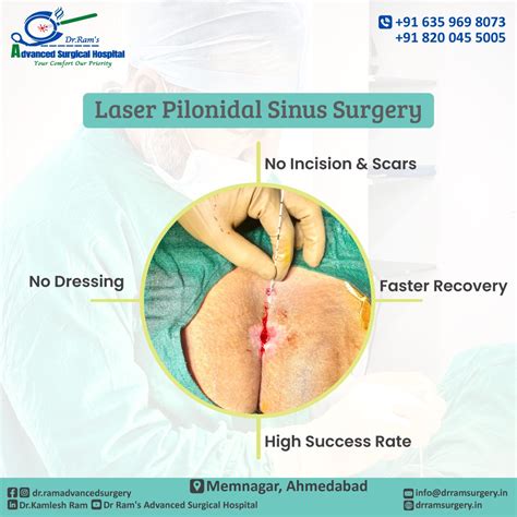 Pilonidal Sinus Not Only Causes Dr Ramsadvancedsurgery