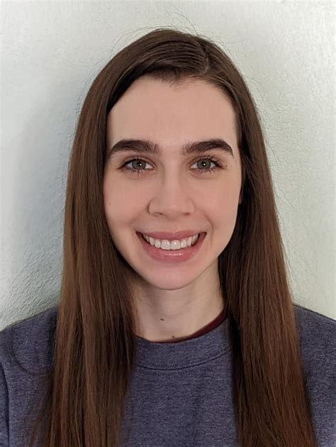 Djs Genioplasty Before And After Class 2 Overjet And Canted Maxilla