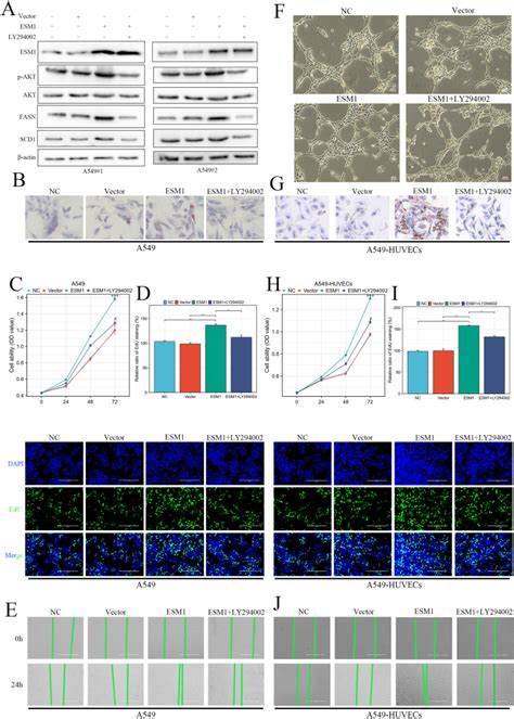 The Role Of Esm1 In The Lipids Metabolic Reprogramming And Angiogenesis