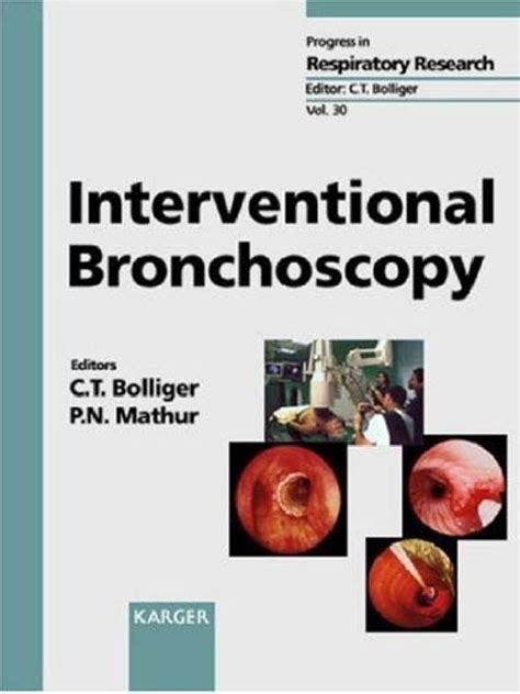 Interventional Bronchoscopy Endoscopy Lung Cancer