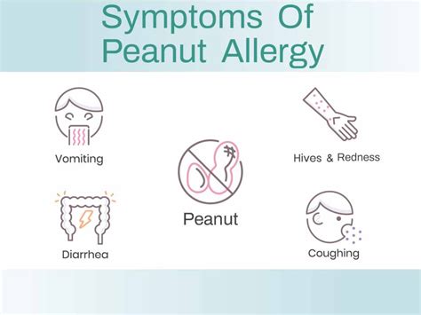 Peanut Allergy Symptoms Causes And Treatment Advanced Food