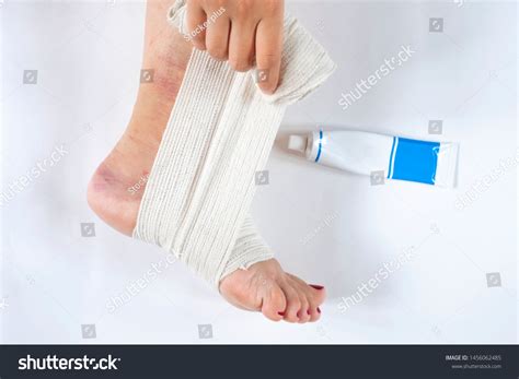 Woman Wrapping Her Leg Sprained Ankle Stock Photo Shutterstock