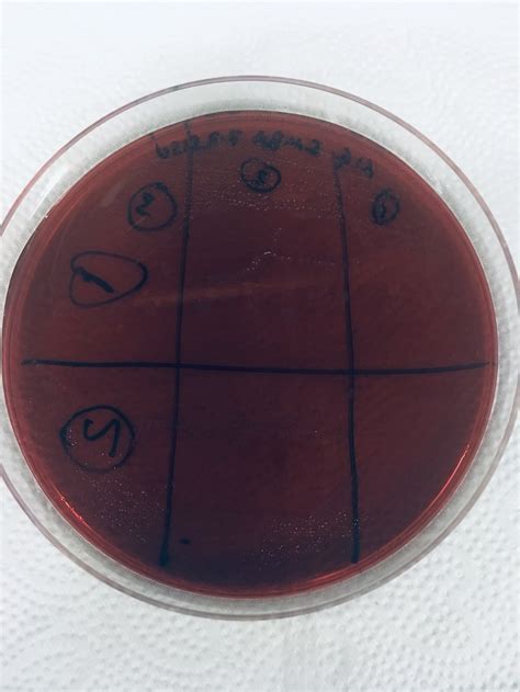 57 Questions With Answers In Dh5 Alpha Cells Science Topic