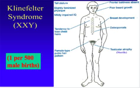 Xxy Chromosome Women