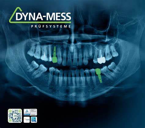 Dyna Mess At Ids 2025 Dyna Mess