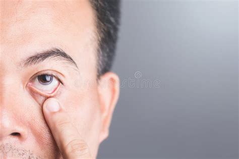 Un Ojo De Pacientes Diabéticos Simbolizando Los Riesgos De Retinopatía