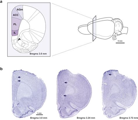 Medial Prefrontal Cortex Medial Prefrontal Cortex