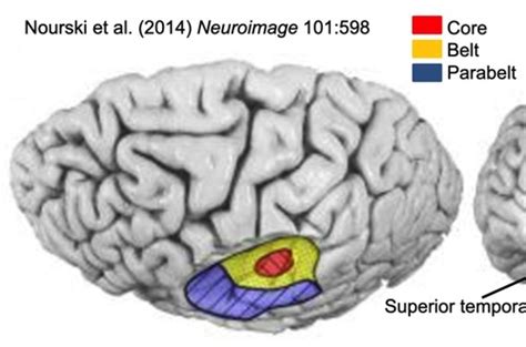 Psych 454 Auditory Cortex And Vestibular System Flashcards Quizlet