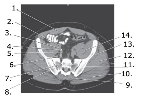 322 Exam 3 Image 10 Diagram Quizlet