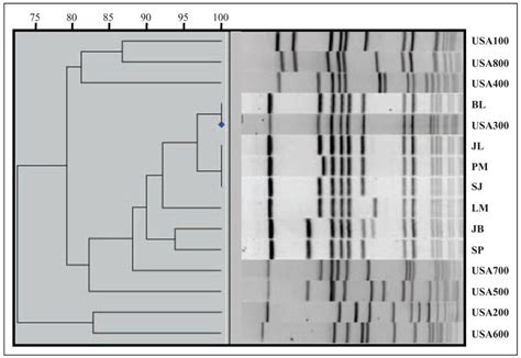 Pulsed Field Gel Profiles Of Smai Digested Chromosomal Dna From Download Scientific Diagram