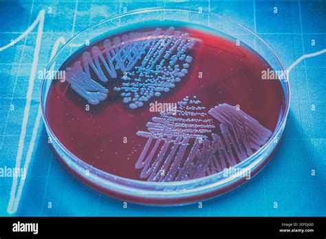 Petri Plate With Bacteria Steptococcus Phaemolifticus G Streptococcus
