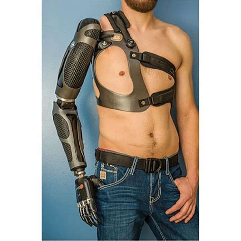 Upper Limb Above Elbow Prosthetic System At ₹ 24970piece In Surat Id
