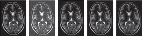 Denoising Results Over Medical Image A Original Medical Image