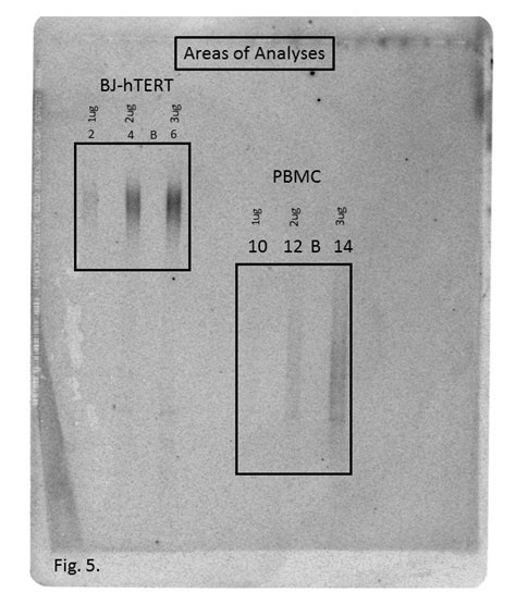 Modified Terminal Restriction Fragment Analysis For Quantifying