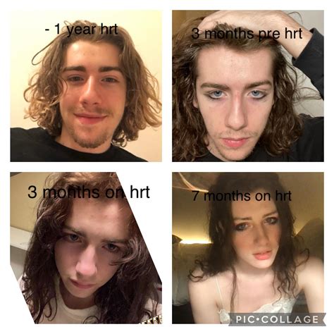 My Transition Journey So Far R Transtimelines