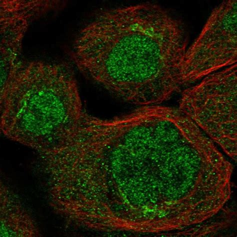 Anti Rassf6 Human Protein Atlas Antibody