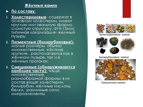 Камни в желчном пузыре Современная диагностика и способы лечения