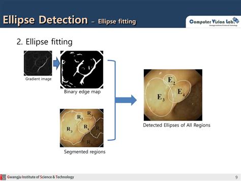 Ppt Polyp Detection In Colonoscopy Video Using Elliptical Shape