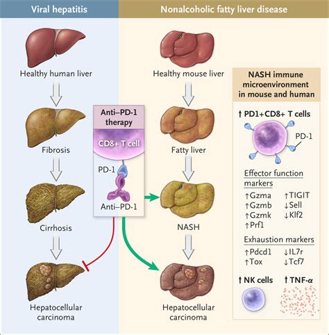 Hepatocellular Carcinoma