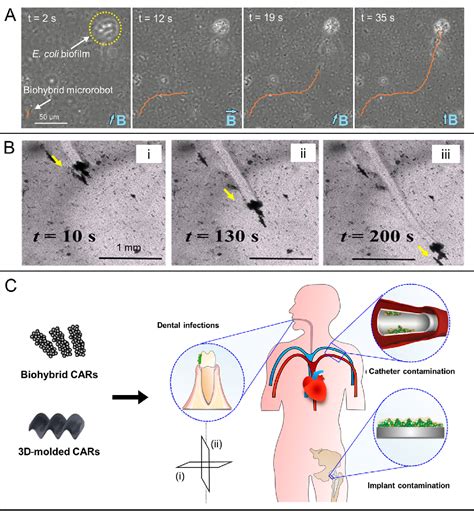 Figure 18 From Magnetically Driven Micro And Nanorobots Semantic Scholar