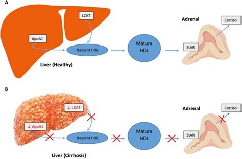 Thematic Issue Adrenal Disease 2022 Endocrine Society Publications