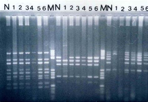 Figure 1 From Archive Of Sid Molecular Analysis Of Iranian Patients