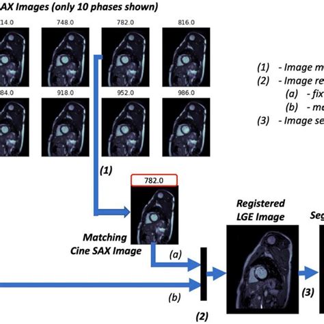 Image Ground Truth Data Pre Processing Pipeline The Trigger Times Tt