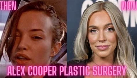Call Her Daddy Alex Cooper Plastic Surgery Rumor 100 Facts