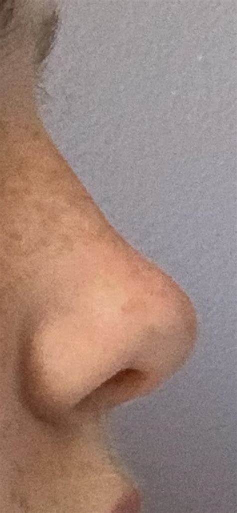 Would This Be Considered A Button Nose Rnoses