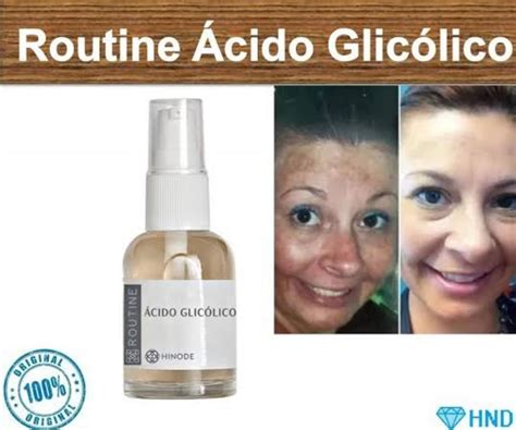 Areta Areta Added A New Photo