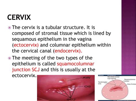 Premalignant Conditions Of The Cervix презентация онлайн