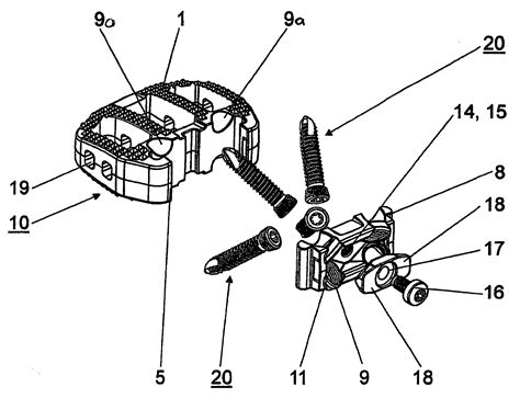 Intervertebral Implant Eureka Patsnap