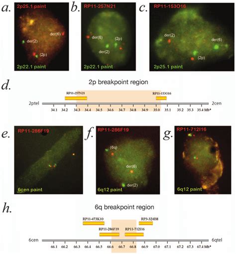 Mapping Of The T26 Breakpoints Using Interphase Fish Analysis A