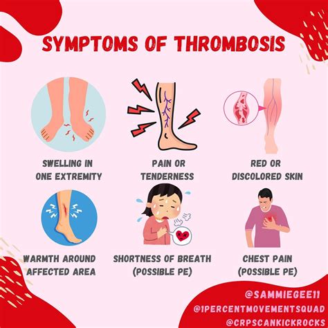 Pin On Pe And Dvt Suvivor
