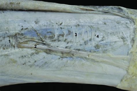 The Course Of The Superficial Peroneal Nerve In The Distal Part Of The