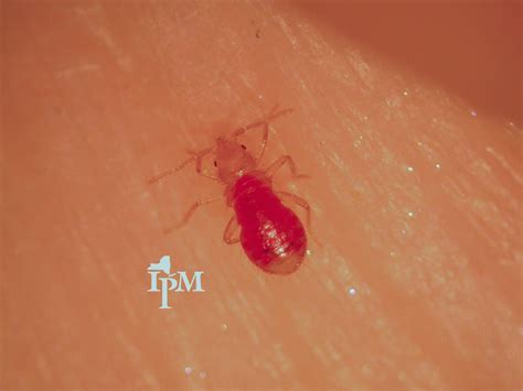 Bed Bug Photos Bed Bug Survivors