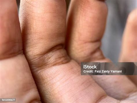Close Up View Of Adult Skin With Finger Knuckle And Detail Texture