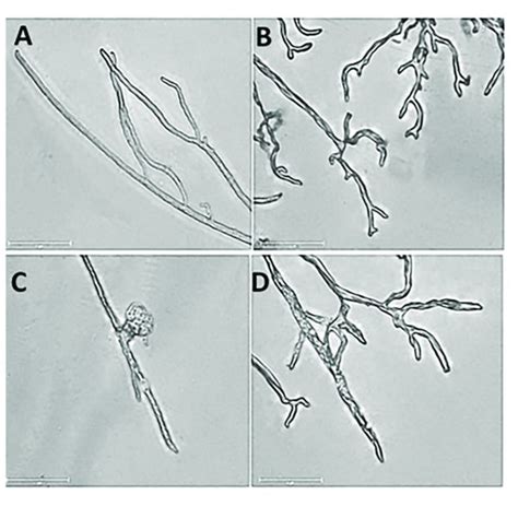 The Mycelial Morphology Of Botryosphaeria Dothidea A The Mycelia