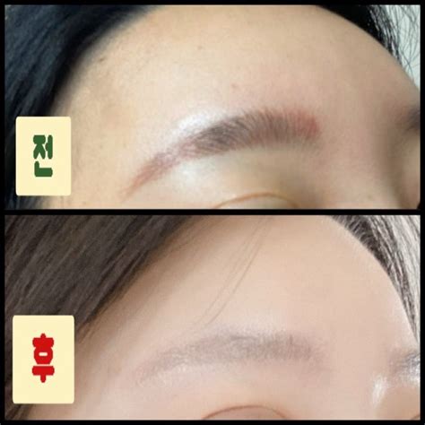 강남 눈썹문신제거 2회차 Feat당일화장가능 네이버 블로그
