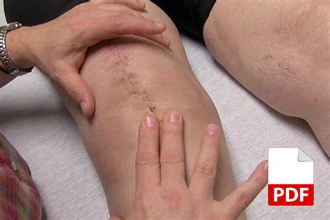 Scar Mobilization — Ice Faculty Zone