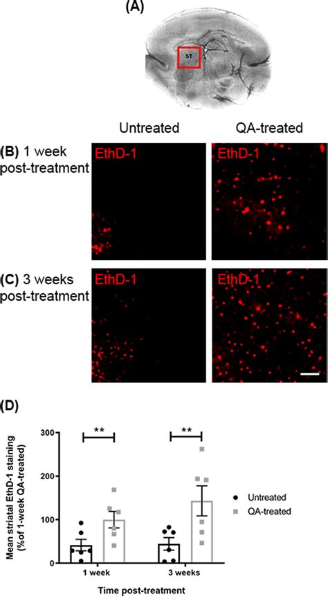 Rat Cortico Striatal Sagittal Organotypic Slice Cultures As Ex Vivo