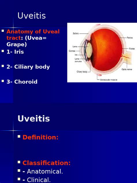Uveitis Pdf Diseases And Disorders Medical Specialties