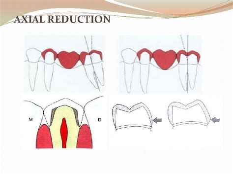 Biological Principles In Fpd The Principles Of Tooth