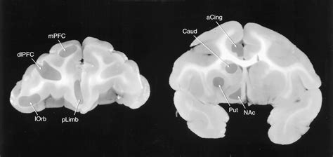 Phencyclidine