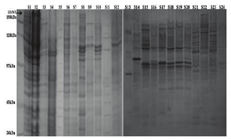 Sds Page Analysis Of Outer Membrane Protein Of Yersinia Enterocolitica Download Scientific
