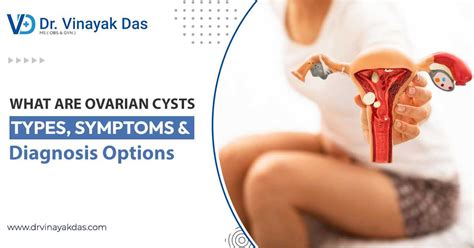 What Are Ovarian Cysts Types Symptoms And Diagnosis Options Dr