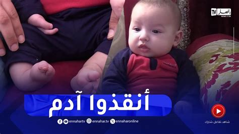 تلمسان عائلة الرضيع آدم تناشد المحسنين لإنقاذ قدمه من البتر Youtube
