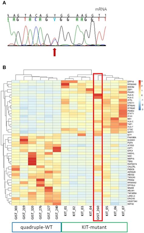 Targeted Deep Sequencing Uncovers Cryptic Kit Mutations In Kitpdgfra